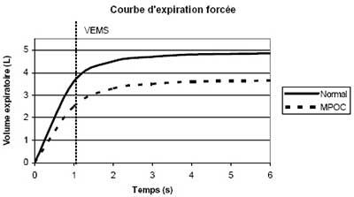 (MPOC = maladie pulmonaire obstructive chronique